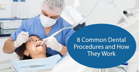 8 Common Dental Procedures and How They Work | Bristol Dental 8 Common Dental Procedures and How They Work | Bristol Dental